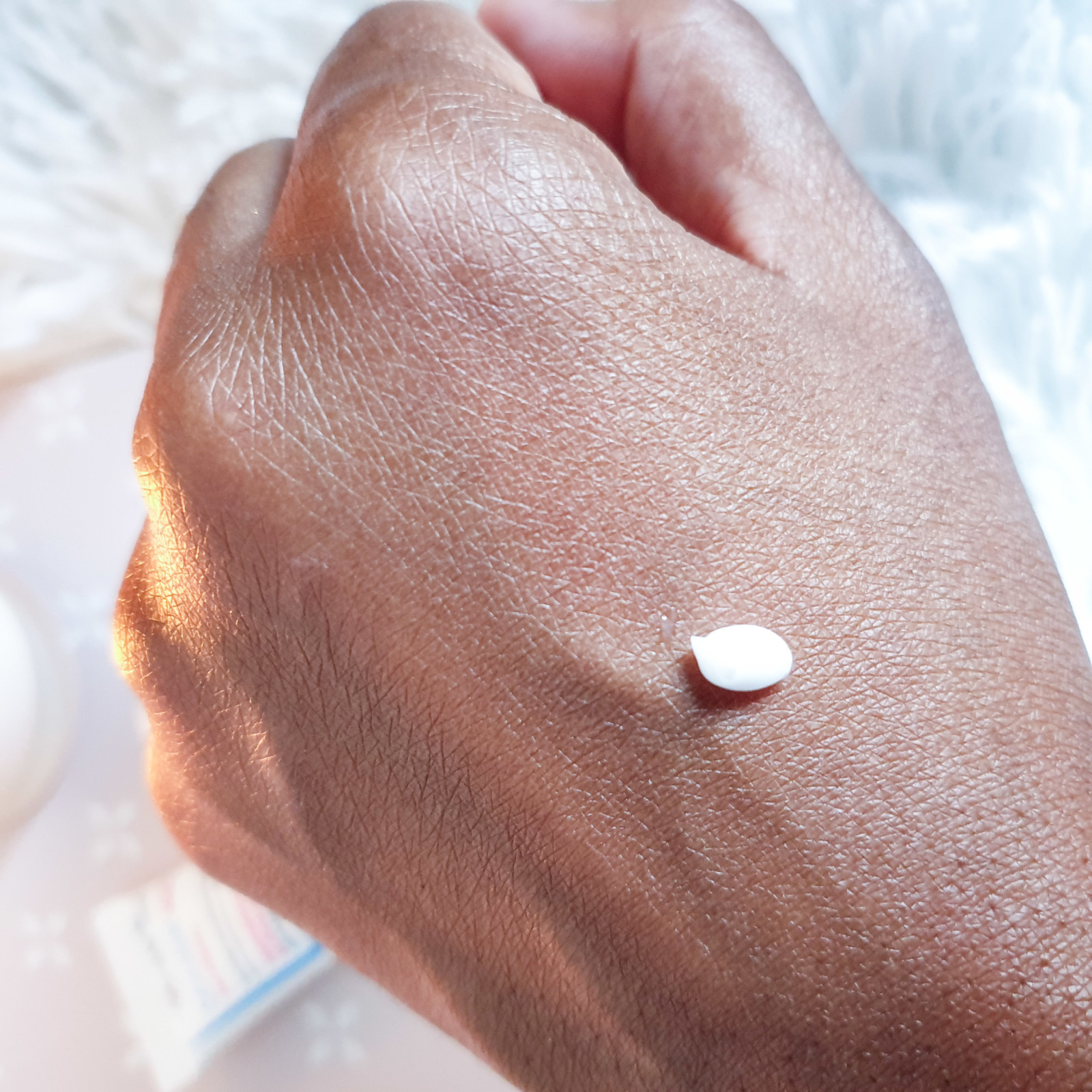 L’éczéma des paupières atopiques – un traitement simple avec Ducray ...